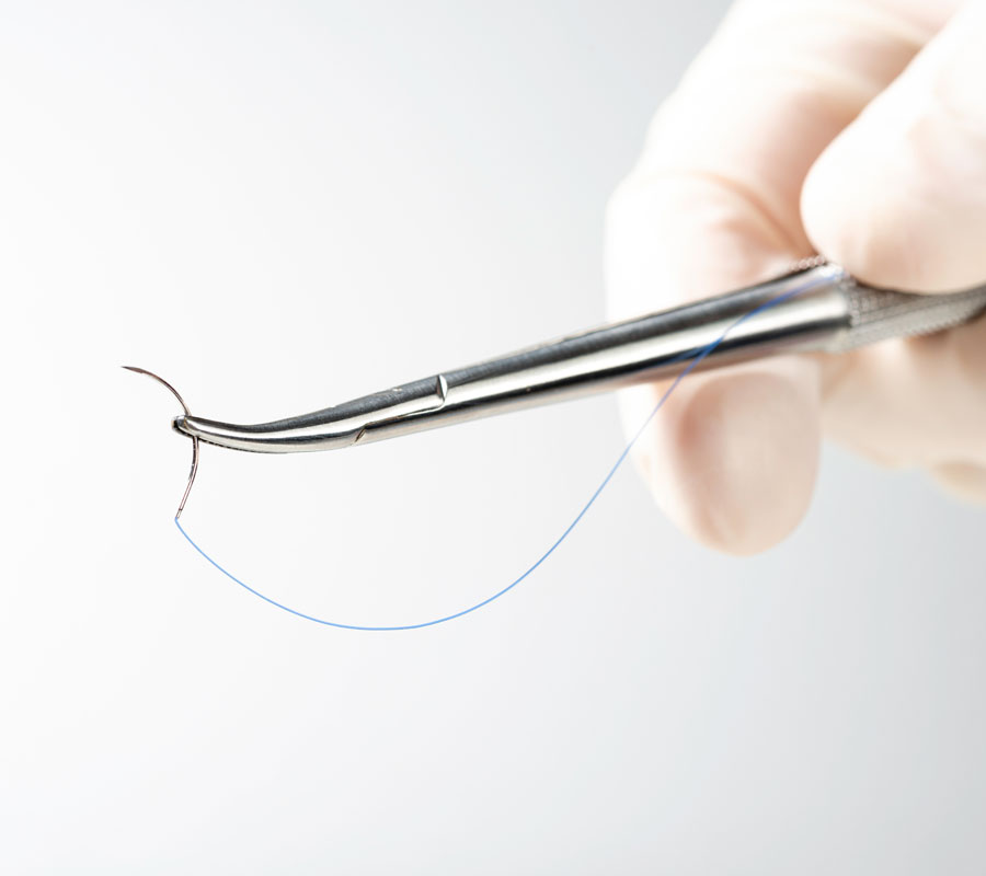 Suture & Staple Removal | Professional Wound Care | iGP